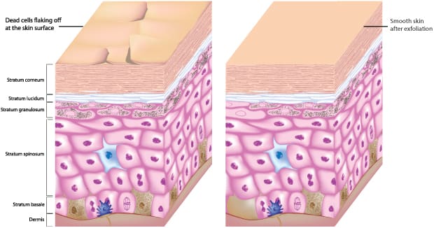 The Science Behind Professional Exfoliation - dermascope