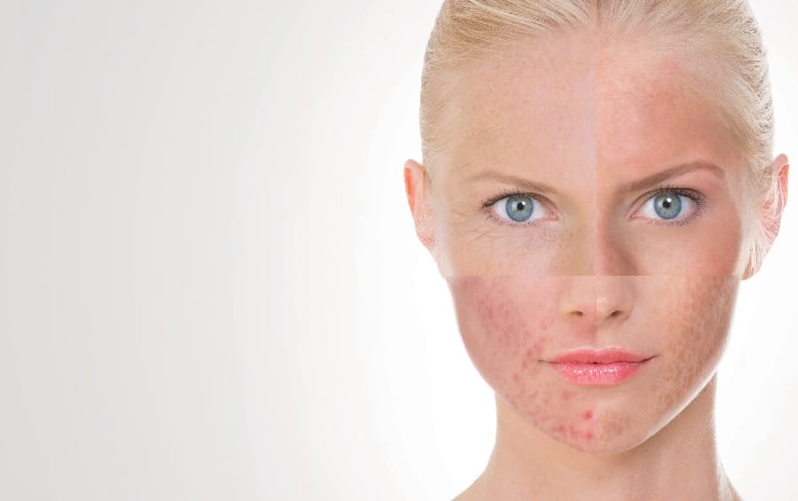 Underlying Causes of Sensitive Skin: Analyzing Internal and External ...