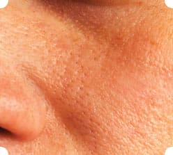 Detecting Skin Sensitivities A Holistic Approach to Sensitive Skin ...