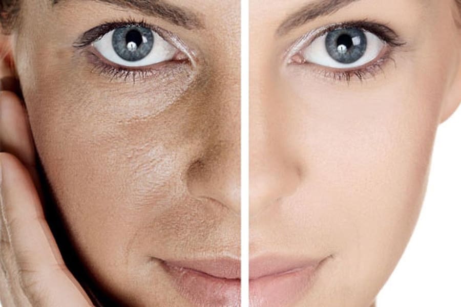 Pore-fect Skin - dermascope